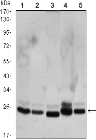 CBX1 Monoclonal Antibody- ELISA科研检测中心-优品生物官网