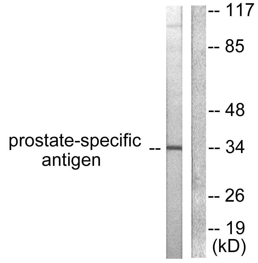PSA Polyclonal Antibody- ELISA科研检测中心-优品生物官网