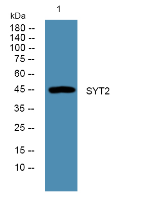 SYT2 Polyclonal Antibody- ELISA科研检测中心-优品生物官网