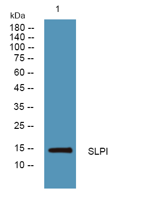 SLPI Polyclonal Antibody- ELISA科研检测中心-优品生物官网