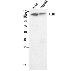 TERT Polyclonal Antibody- ELISA科研检测中心-优品生物官网