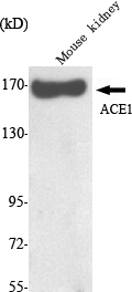 ACE1 Monoclonal Antibody- ELISA科研检测中心-优品生物官网
