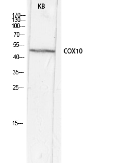 COX10 Polyclonal Antibody- ELISA科研检测中心-优品生物官网