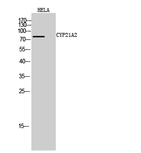 CYP21A2 Polyclonal Antibody- ELISA科研检测中心-优品生物官网