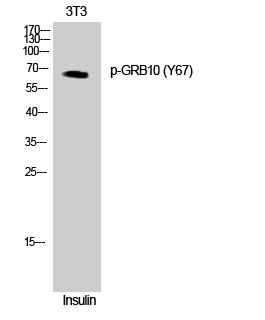 GRB10 (phospho Tyr67) Polyclonal Antibody- ELISA科研检测中心-优品生物官网