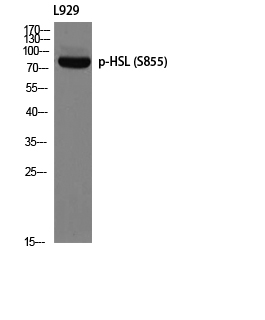 HSL (phospho Ser855) Polyclonal Antibody- ELISA科研检测中心-优品生物官网