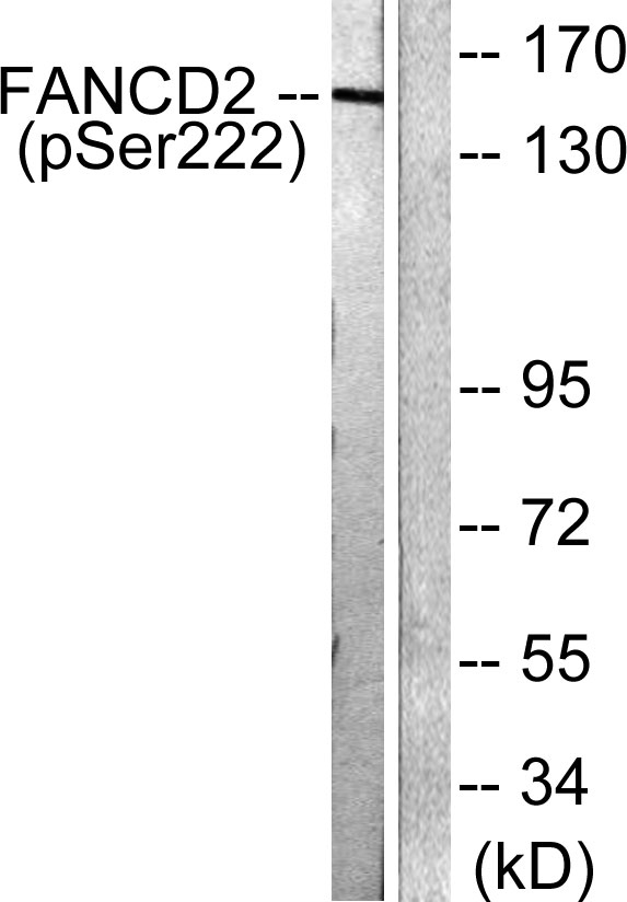 FANCD2 (phospho Ser222) Polyclonal Antibody- ELISA科研检测中心-优品生物官网