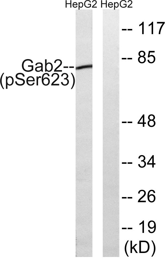 Gab 2 (phospho Ser623) Polyclonal Antibody- ELISA科研检测中心-优品生物官网