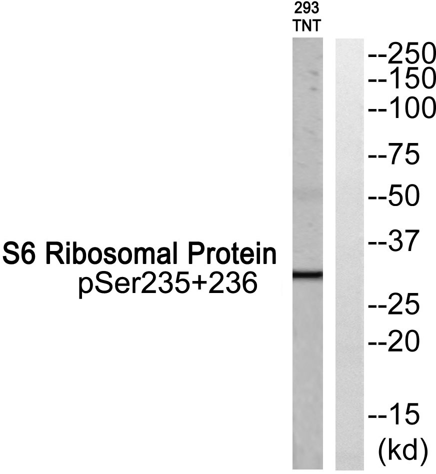 Ribosomal Protein S6 (phospho Ser235/S236) Polyclonal Antibody- ELISA科研检测中心-优品生物官网