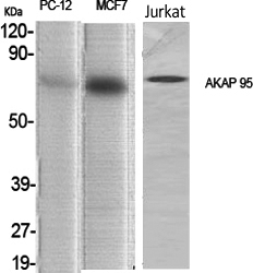 AKAP 95 Polyclonal Antibody- ELISA科研检测中心-优品生物官网