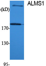 ALMS1 Polyclonal Antibody- ELISA科研检测中心-优品生物官网