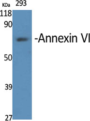 Annexin VI Polyclonal Antibody- ELISA科研检测中心-优品生物官网