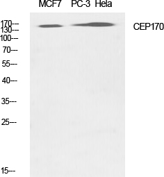 CEP170 Polyclonal Antibody- ELISA科研检测中心-优品生物官网