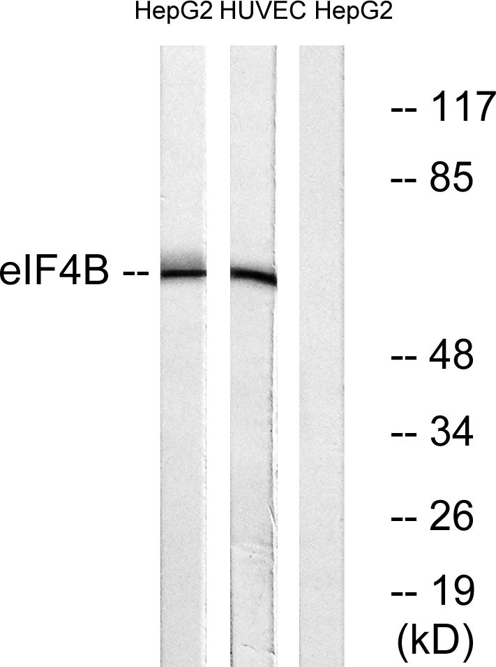 eIF4B Polyclonal Antibody- ELISA科研检测中心-优品生物官网