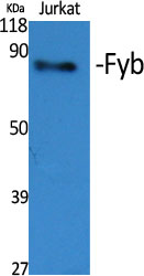 Fyb Polyclonal Antibody- ELISA科研检测中心-优品生物官网