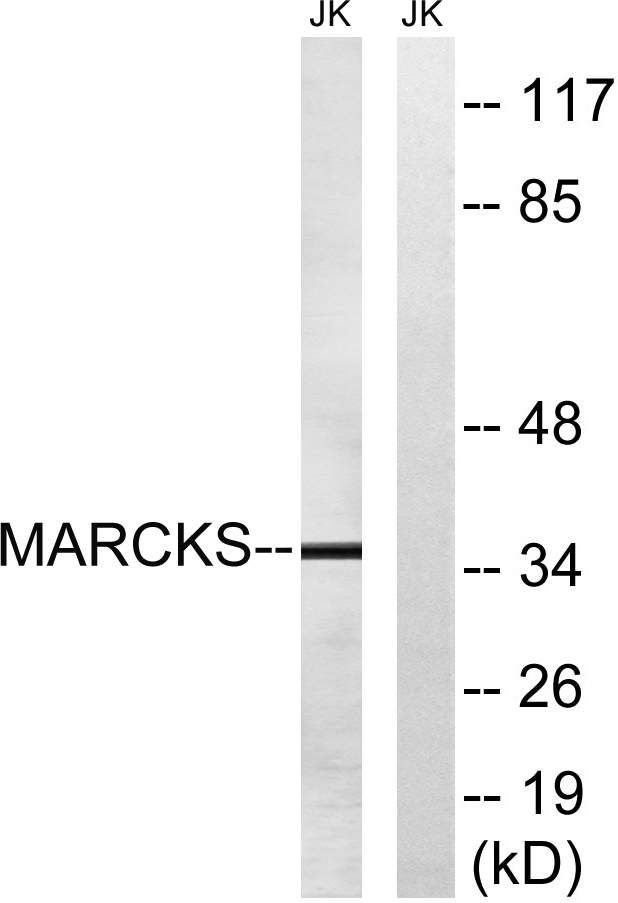 MARCKS Polyclonal Antibody- ELISA科研检测中心-优品生物官网