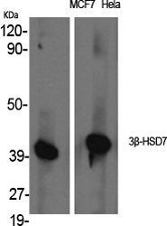 3β-HSD7 Polyclonal Antibody- ELISA科研检测中心-优品生物官网