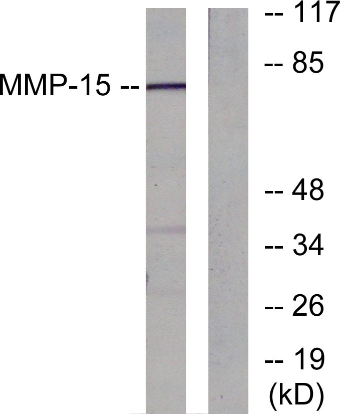 MMP-15 Polyclonal Antibody- ELISA科研检测中心-优品生物官网
