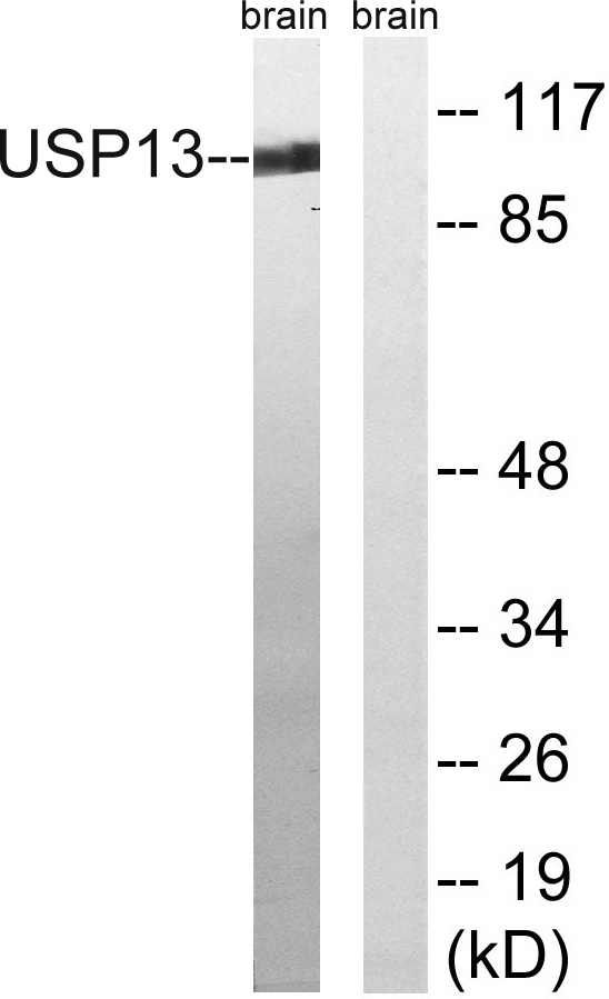 USP13 Polyclonal Antibody- ELISA科研检测中心-优品生物官网
