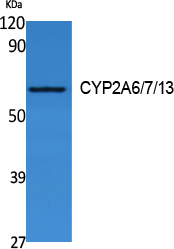 CYP2A6/7/13 Polyclonal Antibody- ELISA科研检测中心-优品生物官网