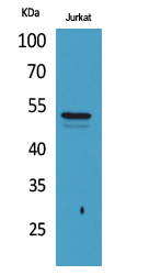 Tubulin α (Acetyl Lys40) Polyclonal Antibody- ELISA科研检测中心-优品生物官网