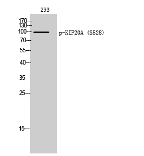 KIF20A (phospho Ser528) Polyclonal Antibody- ELISA科研检测中心-优品生物官网