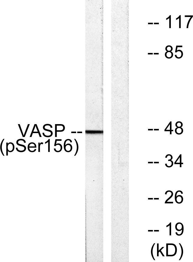 VASP (phospho Ser157) Polyclonal Antibody- ELISA科研检测中心-优品生物官网