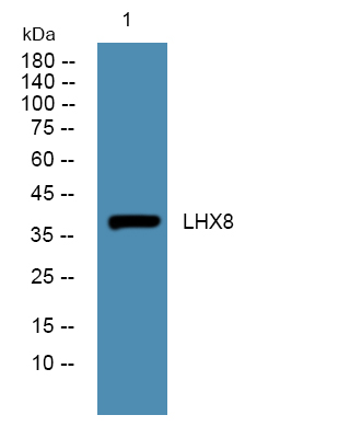 LHX8 Polyclonal Antibody- ELISA科研检测中心-优品生物官网