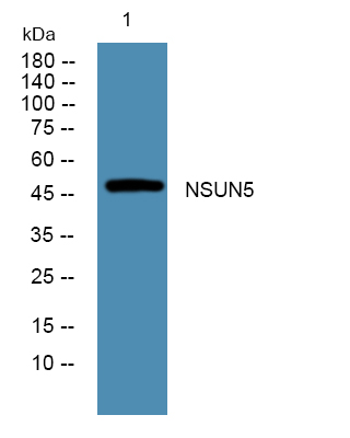 NSUN5 Polyclonal Antibody- ELISA科研检测中心-优品生物官网