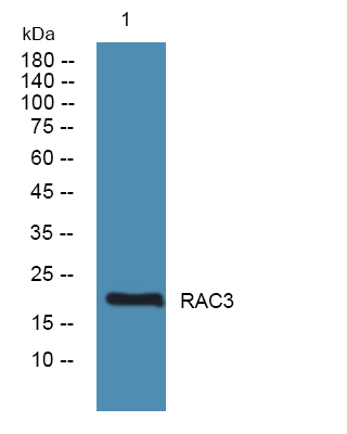 RAC3 Polyclonal Antibody- ELISA科研检测中心-优品生物官网