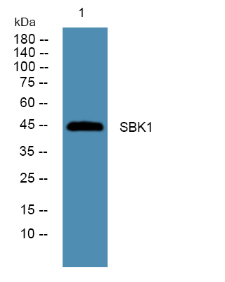 SBK1 Polyclonal Antibody- ELISA科研检测中心-优品生物官网