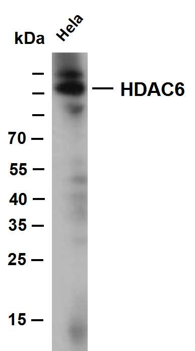 HDAC6 (ABT-HDAC6) mouse mAb- ELISA科研检测中心-优品生物官网