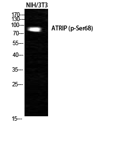 ATRIP (phospho Ser68) Polyclonal Antibody- ELISA科研检测中心-优品生物官网