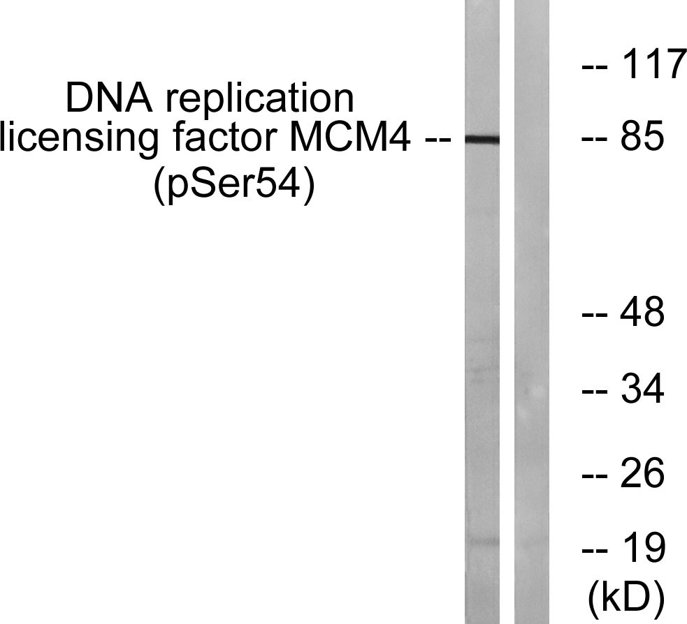 MCM4 (phospho Ser54) Polyclonal Antibody- ELISA科研检测中心-优品生物官网