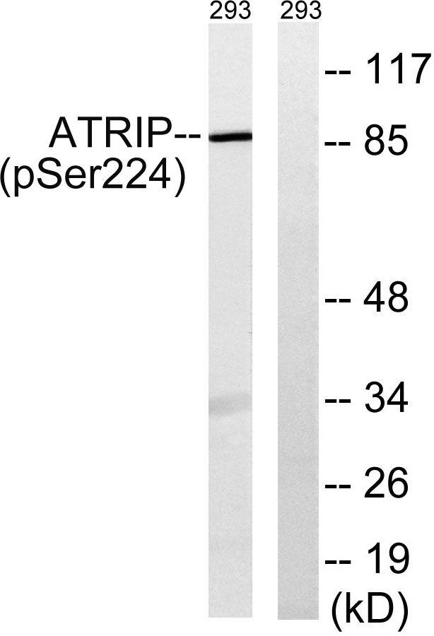 ATRIP (phospho Ser224) Polyclonal Antibody- ELISA科研检测中心-优品生物官网