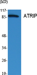 ATRIP Polyclonal Antibody- ELISA科研检测中心-优品生物官网