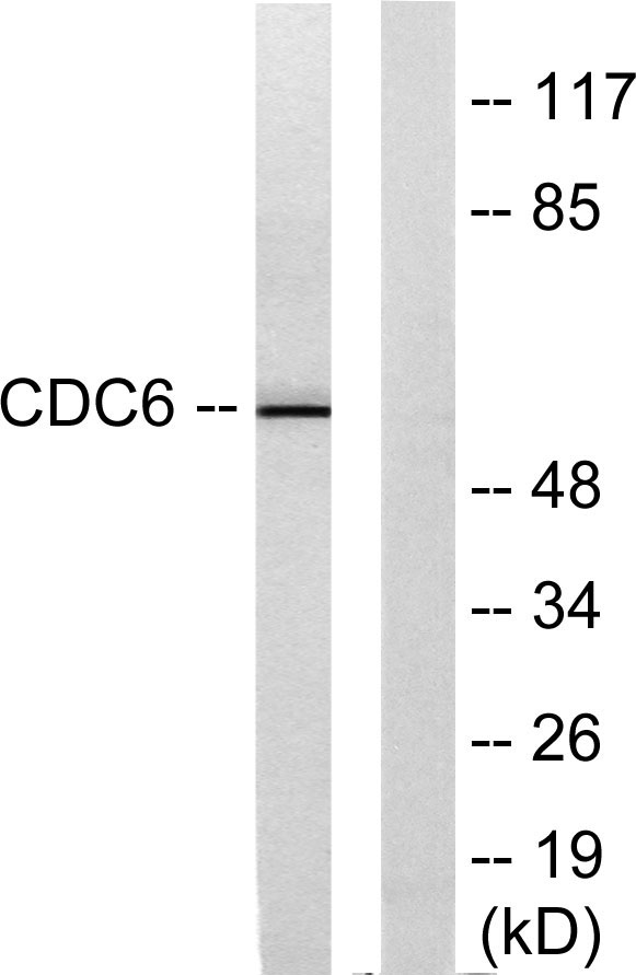 Cdc6 Polyclonal Antibody- ELISA科研检测中心-优品生物官网