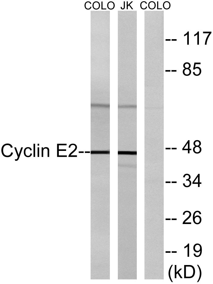 Cyclin E2 Polyclonal Antibody- ELISA科研检测中心-优品生物官网