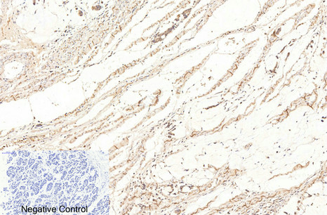 Cleaved-Caspase-1 p20 (D210) Monoclonal Antibody- ELISA科研检测中心-优品生物官网