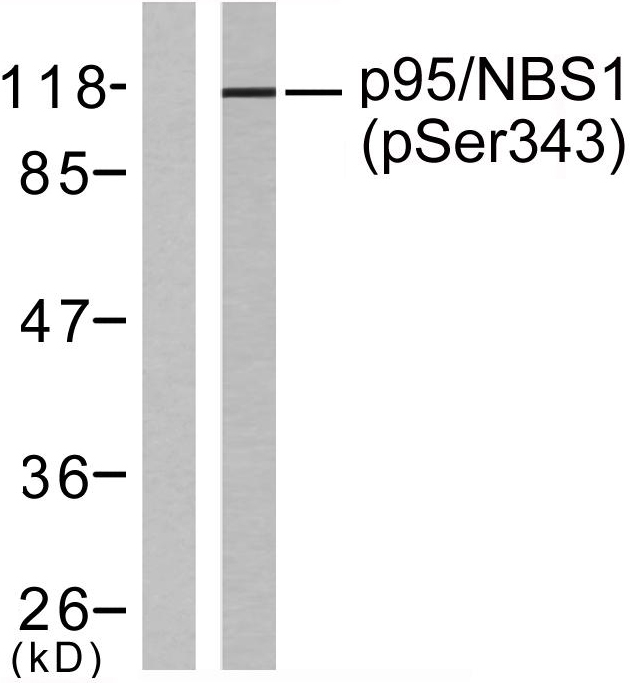 Nibrin (phospho Ser343) Monoclonal Antibody- ELISA科研检测中心-优品生物官网