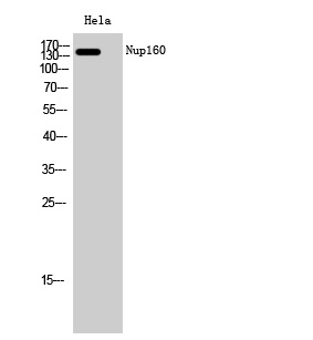 Nup160 Monoclonal Antibody- ELISA科研检测中心-优品生物官网