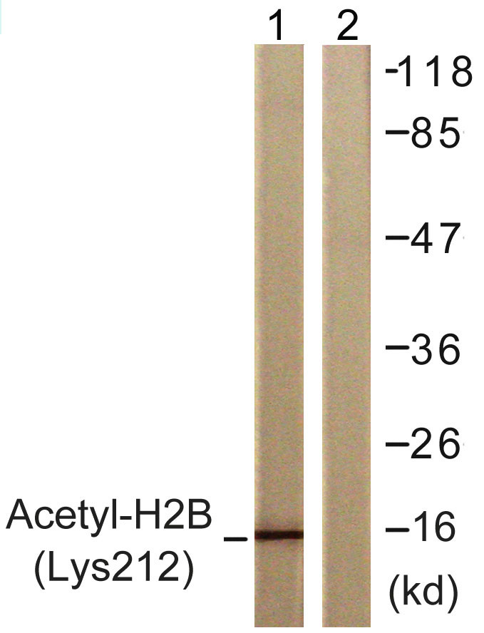 Acetyl Histone H2B (K12) Monoclonal Antibody- ELISA科研检测中心-优品生物官网