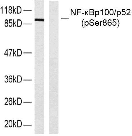 NFκB-p100 (phospho Ser865) Monoclonal Antibody- ELISA科研检测中心-优品生物官网
