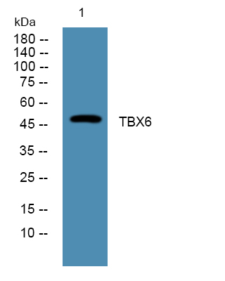 TBX6 Monoclonal Antibody- ELISA科研检测中心-优品生物官网
