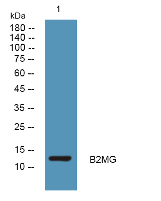 B2MG Monoclonal Antibody- ELISA科研检测中心-优品生物官网
