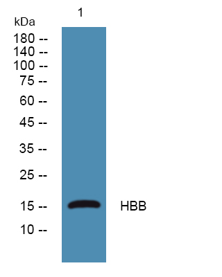HBB Monoclonal Antibody- ELISA科研检测中心-优品生物官网