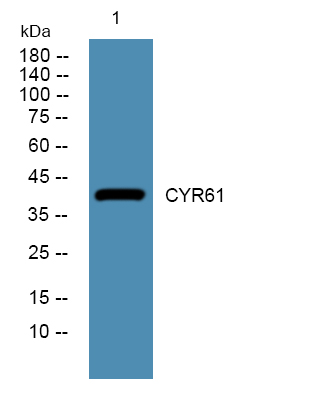CYR61 Monoclonal Antibody- ELISA科研检测中心-优品生物官网