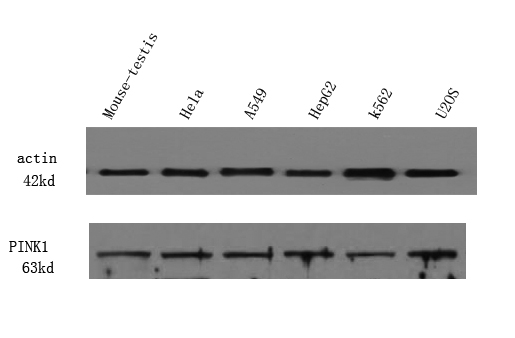 PINK1 Monoclonal Antibody- ELISA科研检测中心-优品生物官网