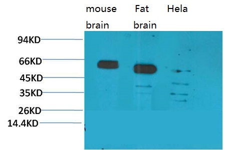 CCKBR Monoclonal Antibody- ELISA科研检测中心-优品生物官网