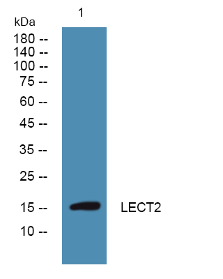 LECT2 Monoclonal Antibody- ELISA科研检测中心-优品生物官网